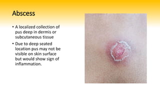 Basic skin lesions | PPTX