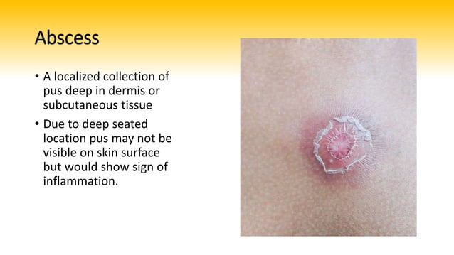 Basic skin lesions | PPTX | Skin and Dermatology | Diseases and Conditions