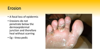 Basic skin lesions | PPTX