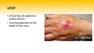 Basic skin lesions | PPTX