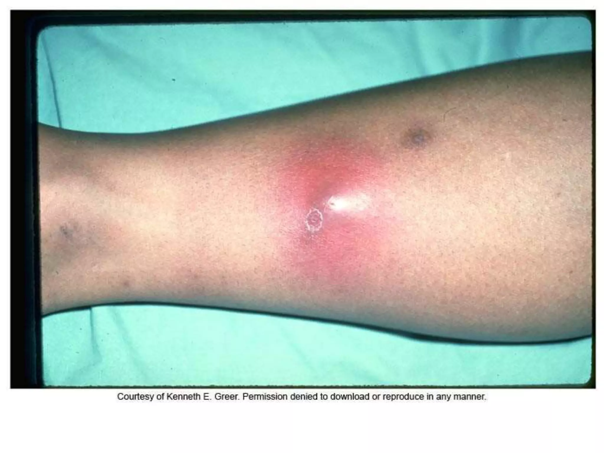 Basic skin lesions.ppt