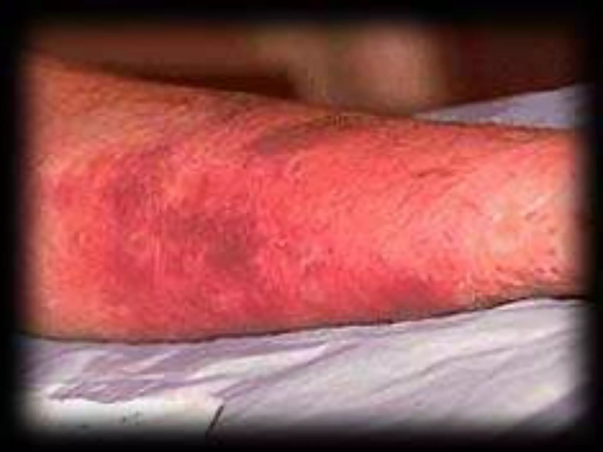 Basic skin lesions.ppt