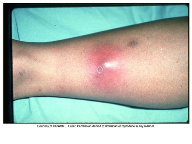Basic skin lesions.ppt