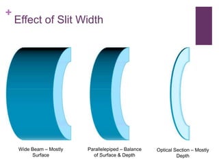 Basic Slit Lamp Biomicroscopy | PPTX