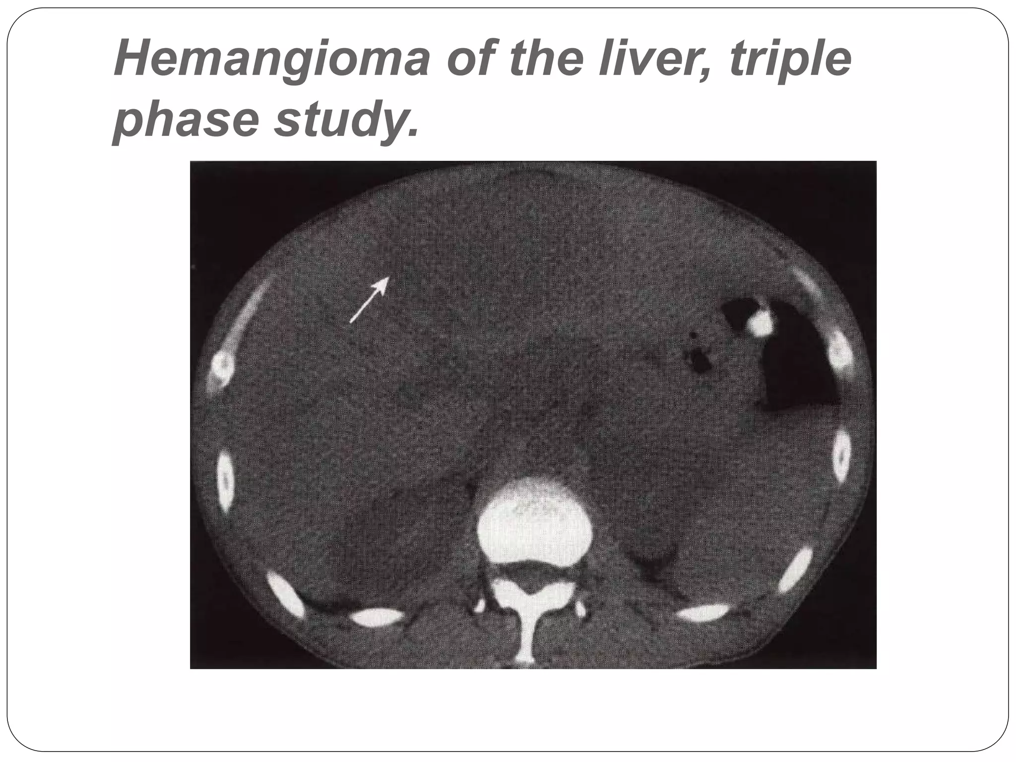Basics of abdominal CT scan.pptx
