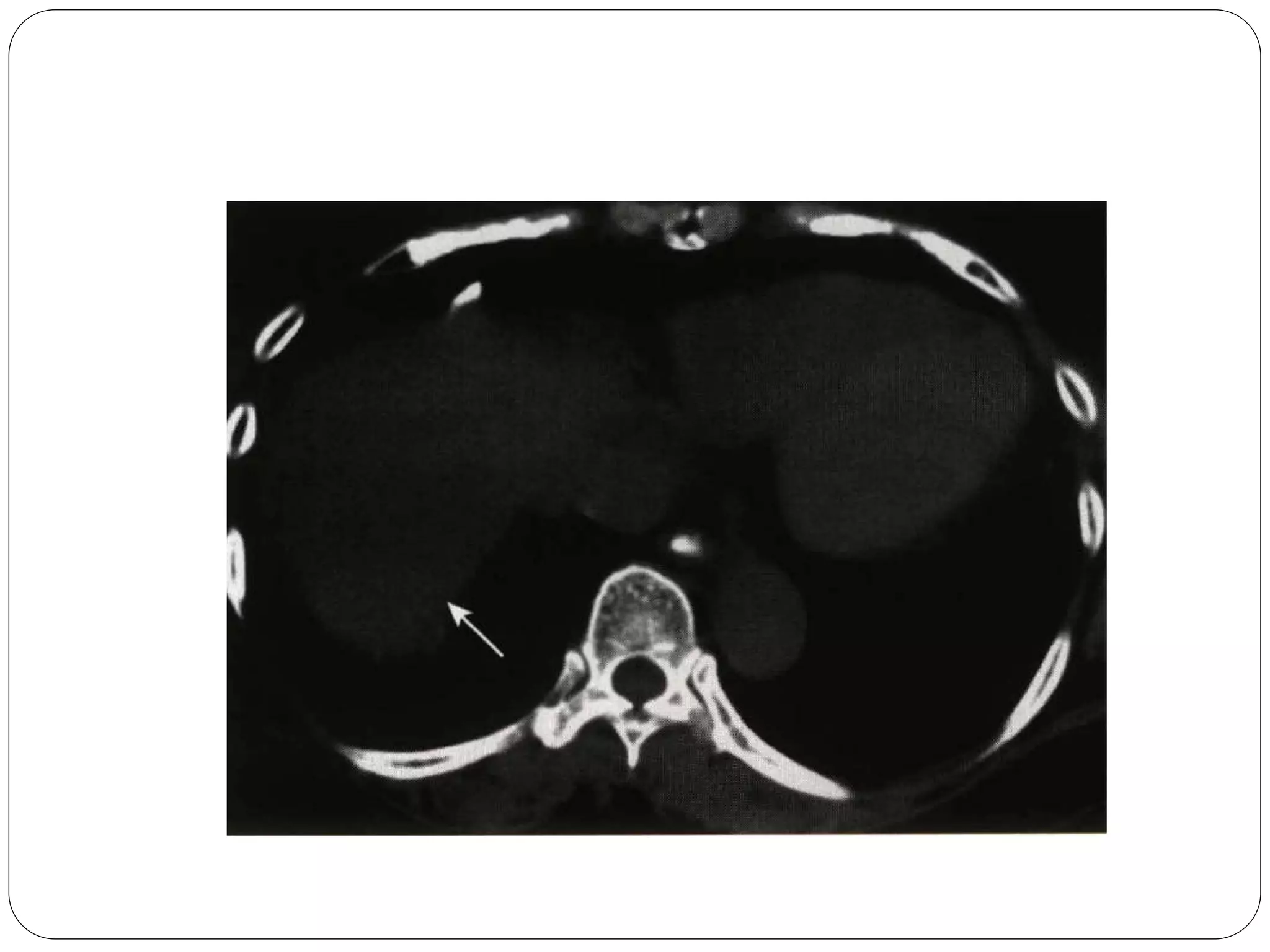 Basics Of Abdominal Ct Scan Pptx