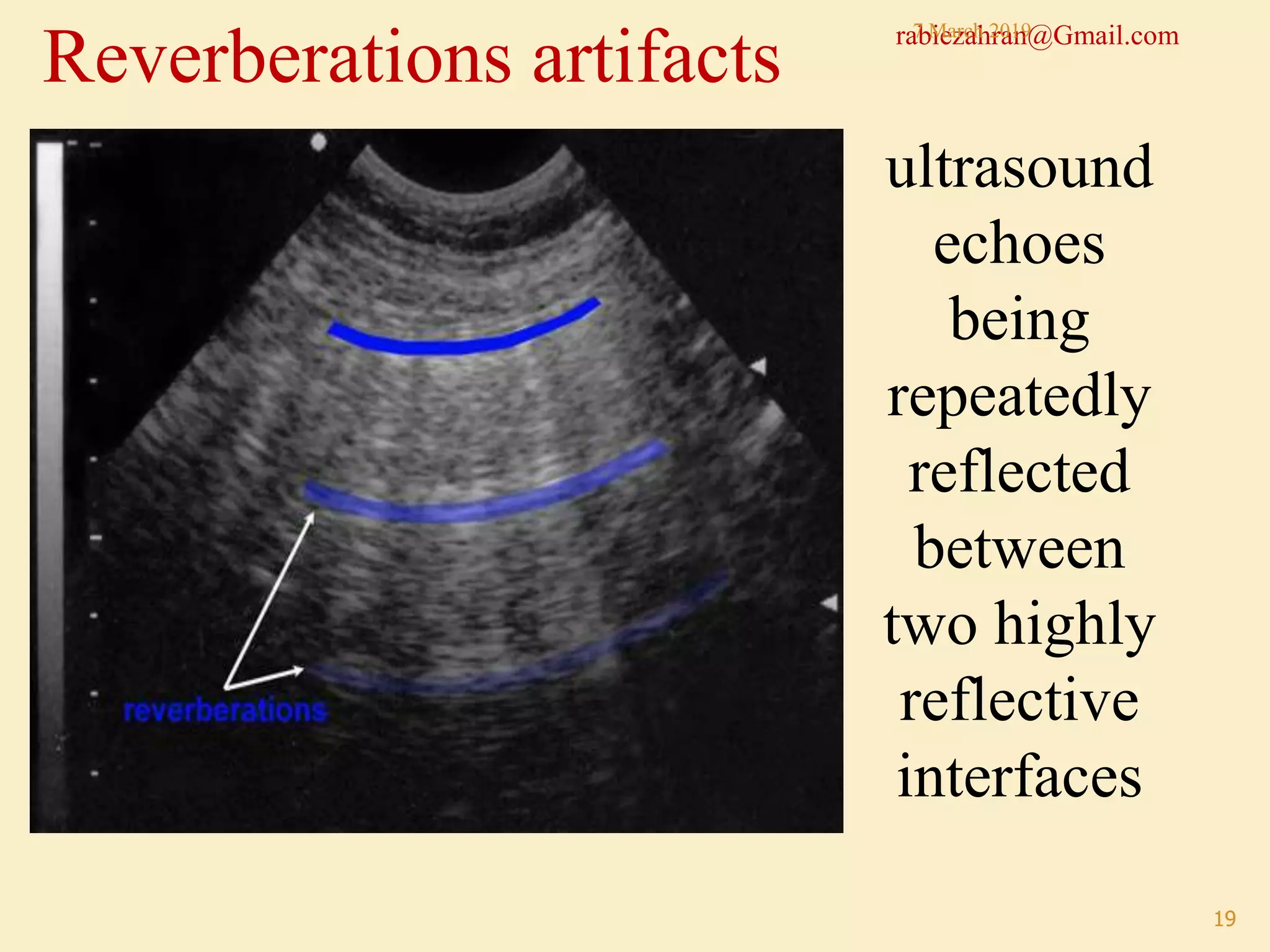 Basics of abdominal ultrasonography | PPTX