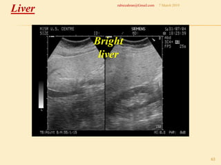 Basics of abdominal ultrasonography | PPTX