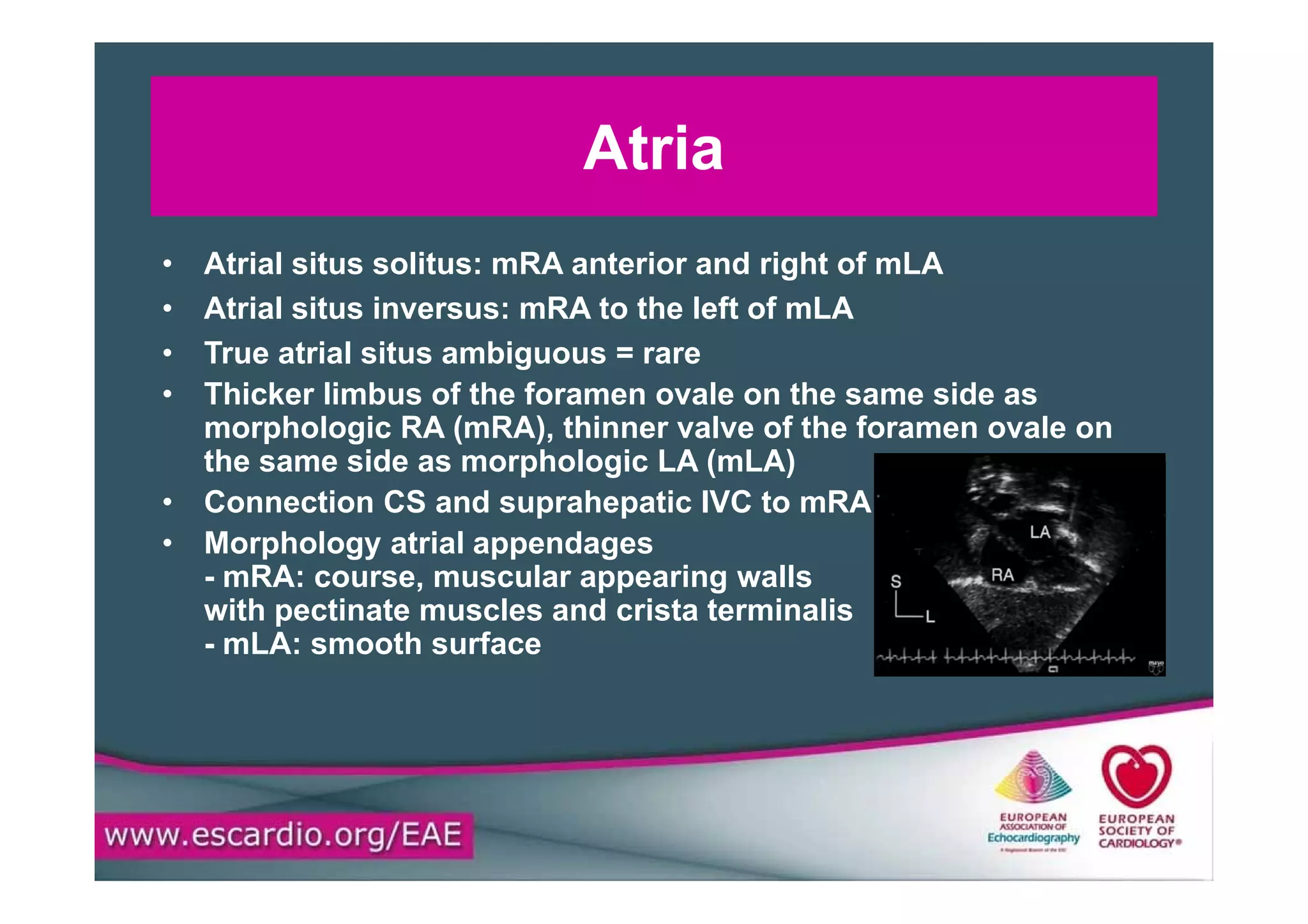 Basics of adult congenital heart disease assessment | PDF