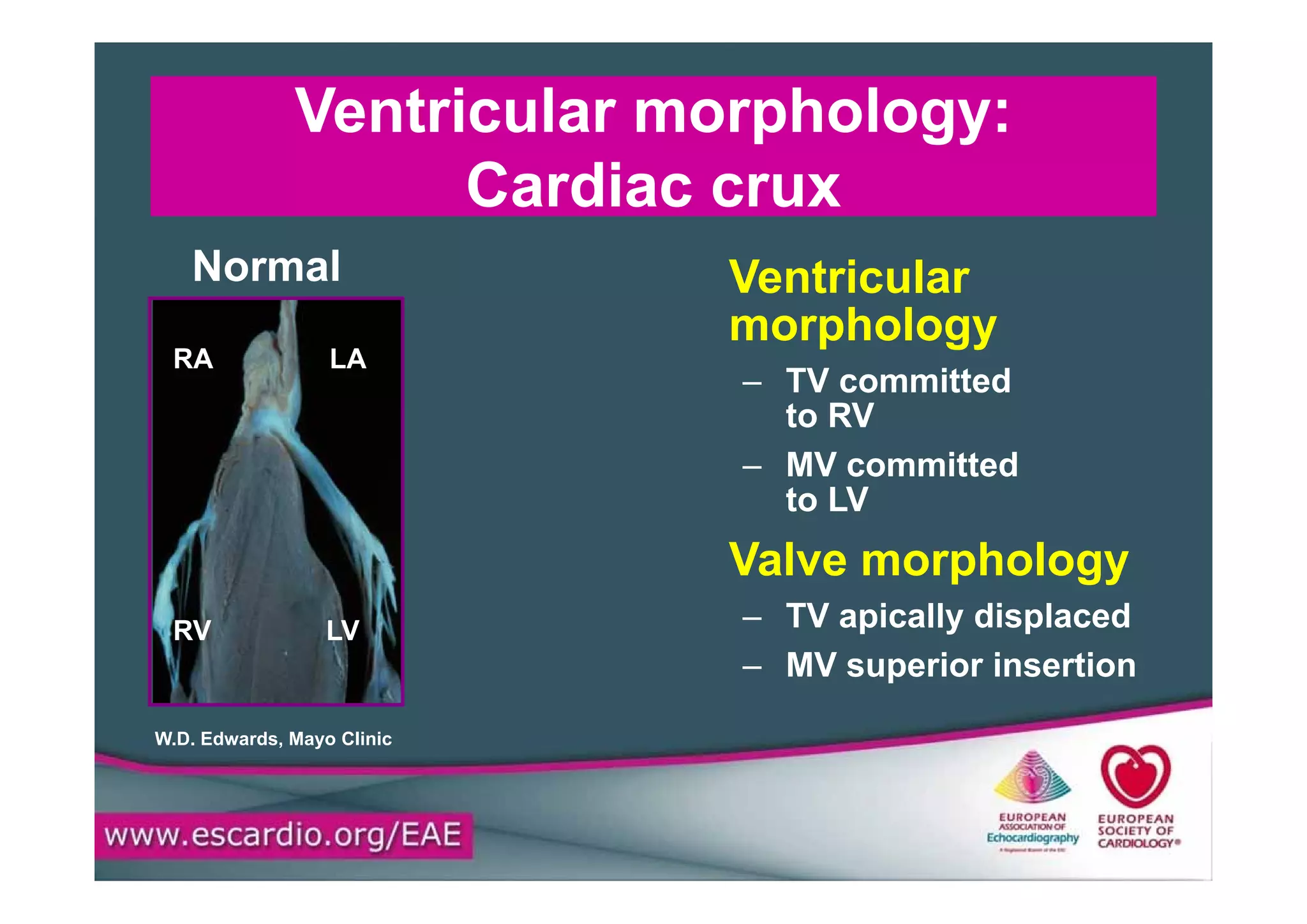 Basics of adult congenital heart disease assessment | PDF