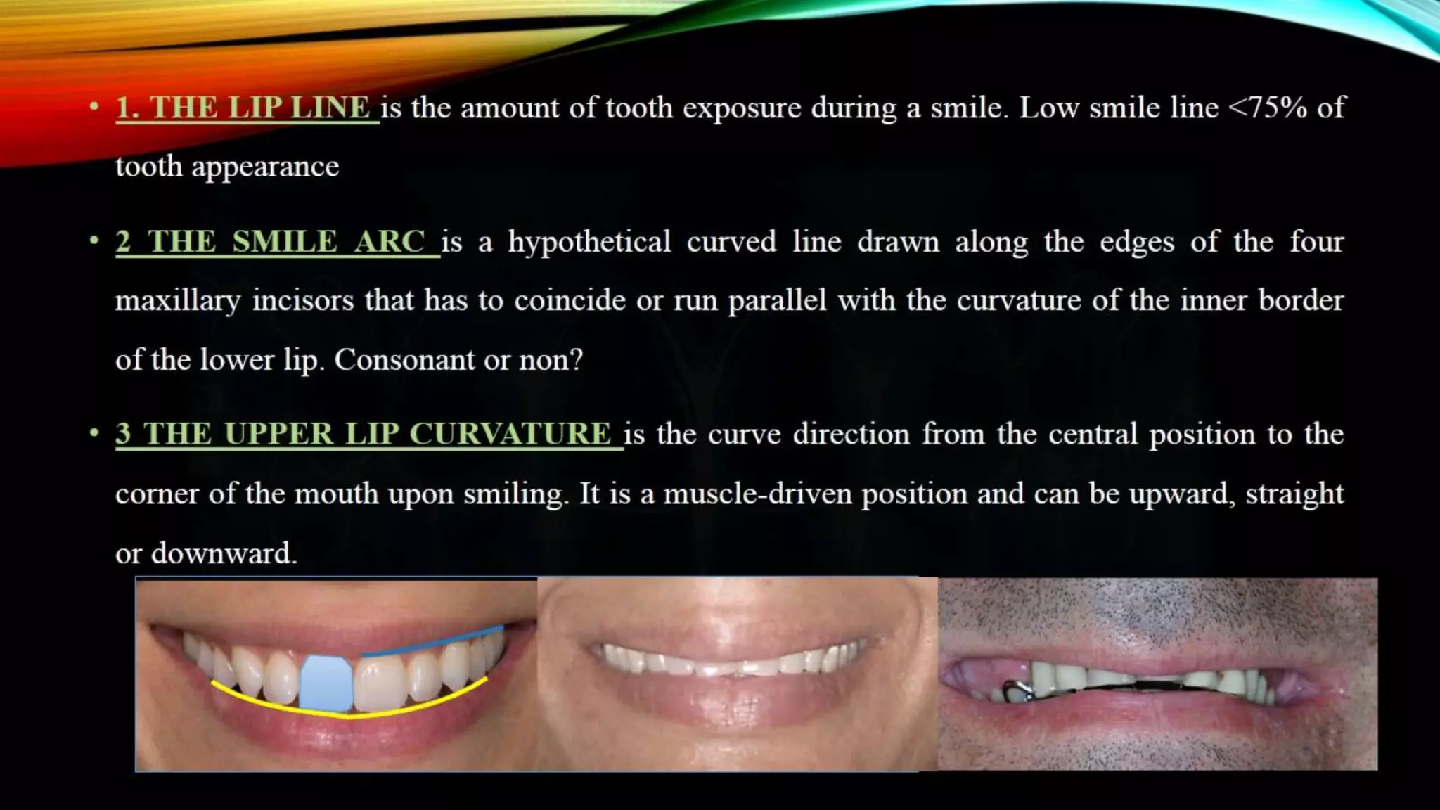 Basics for aesthetic smile | PPT