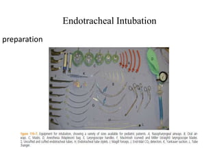 Basics of airway management april 2018 | PPT