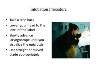 Basics of airway management april 2018 | PPT