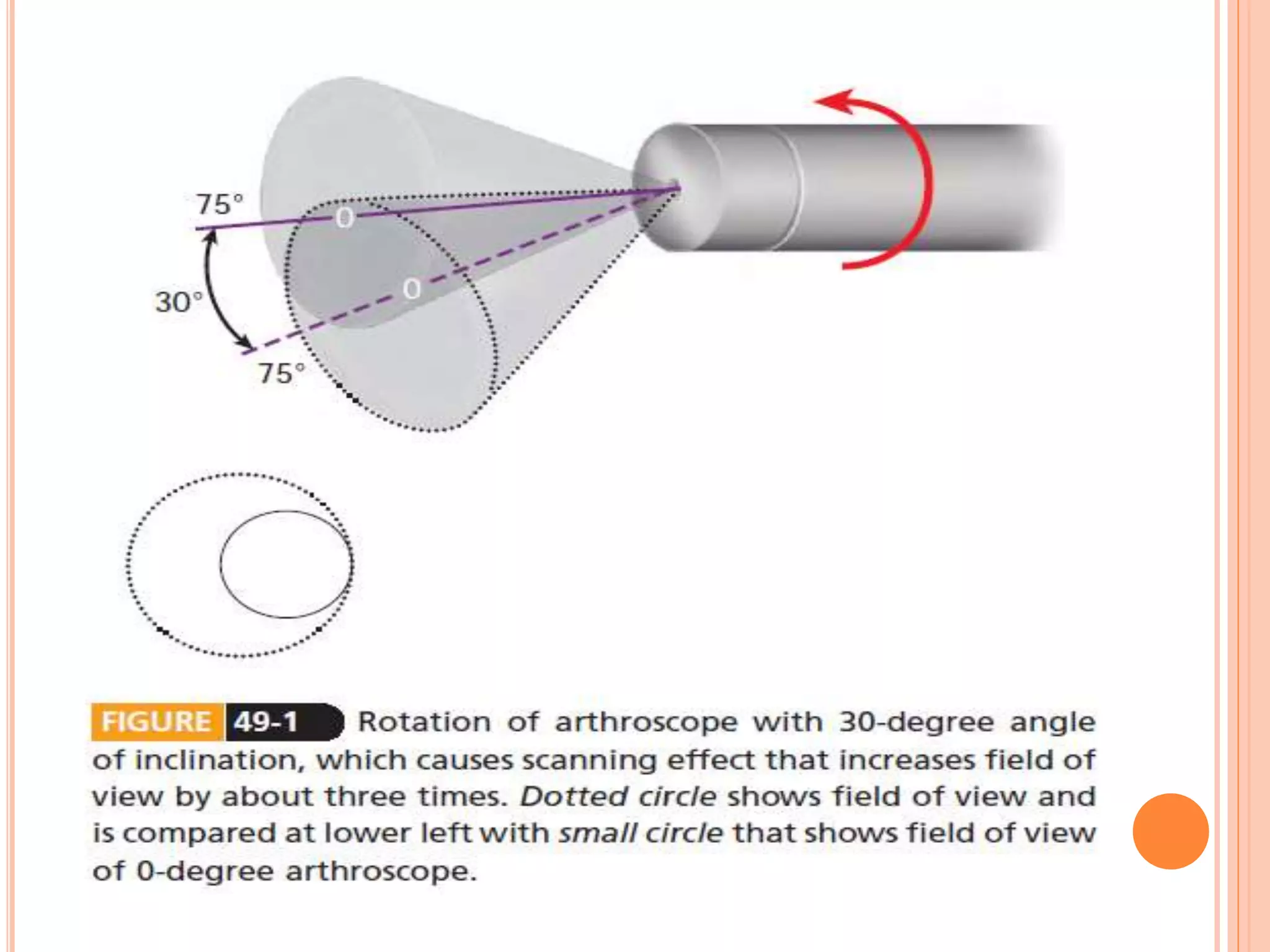 Basics of arthroscopy ppt | PPTX