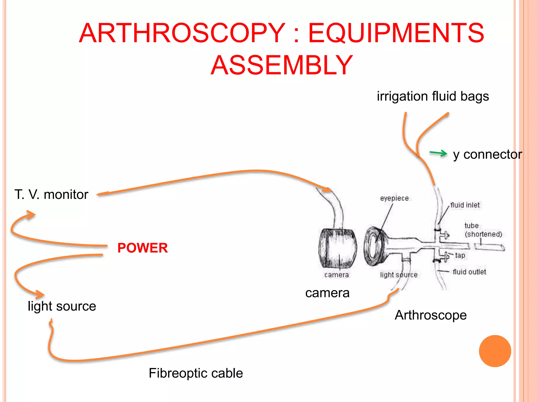 Basics of arthroscopy ppt | PPTX