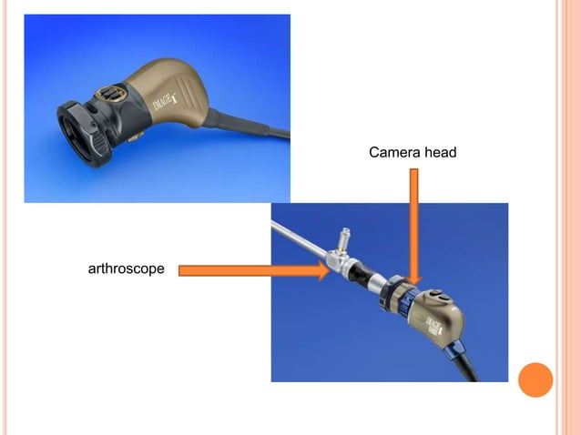 Basics of arthroscopy ppt