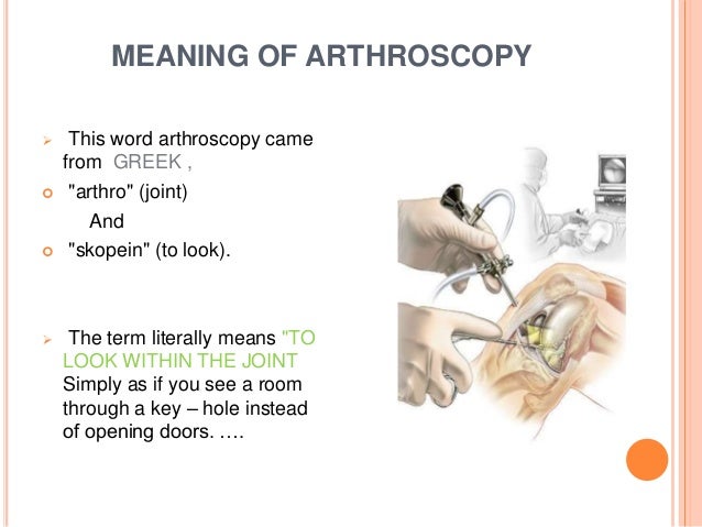 Basics of arthroscopy ppt