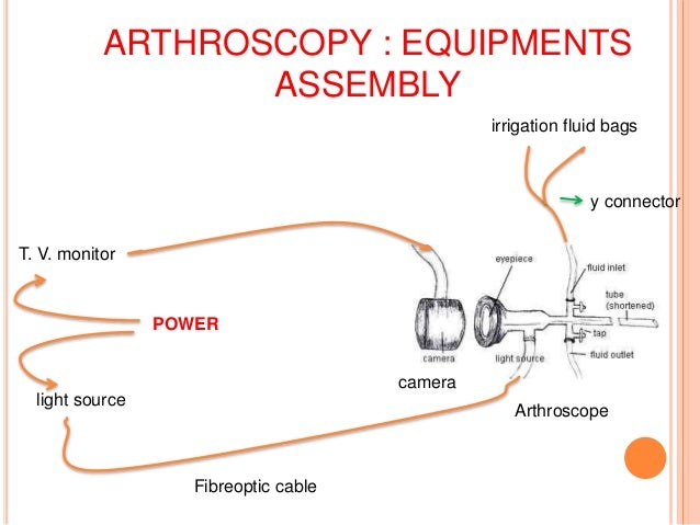 Basics of arthroscopy ppt