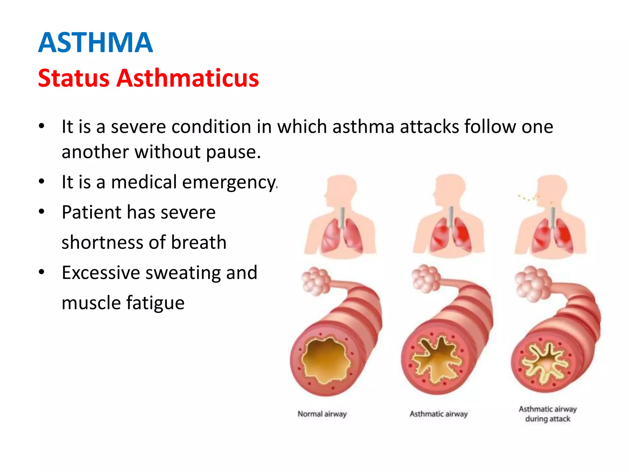 Basics of Bronchial asthma by Dr Qurban Hussain | PPTX