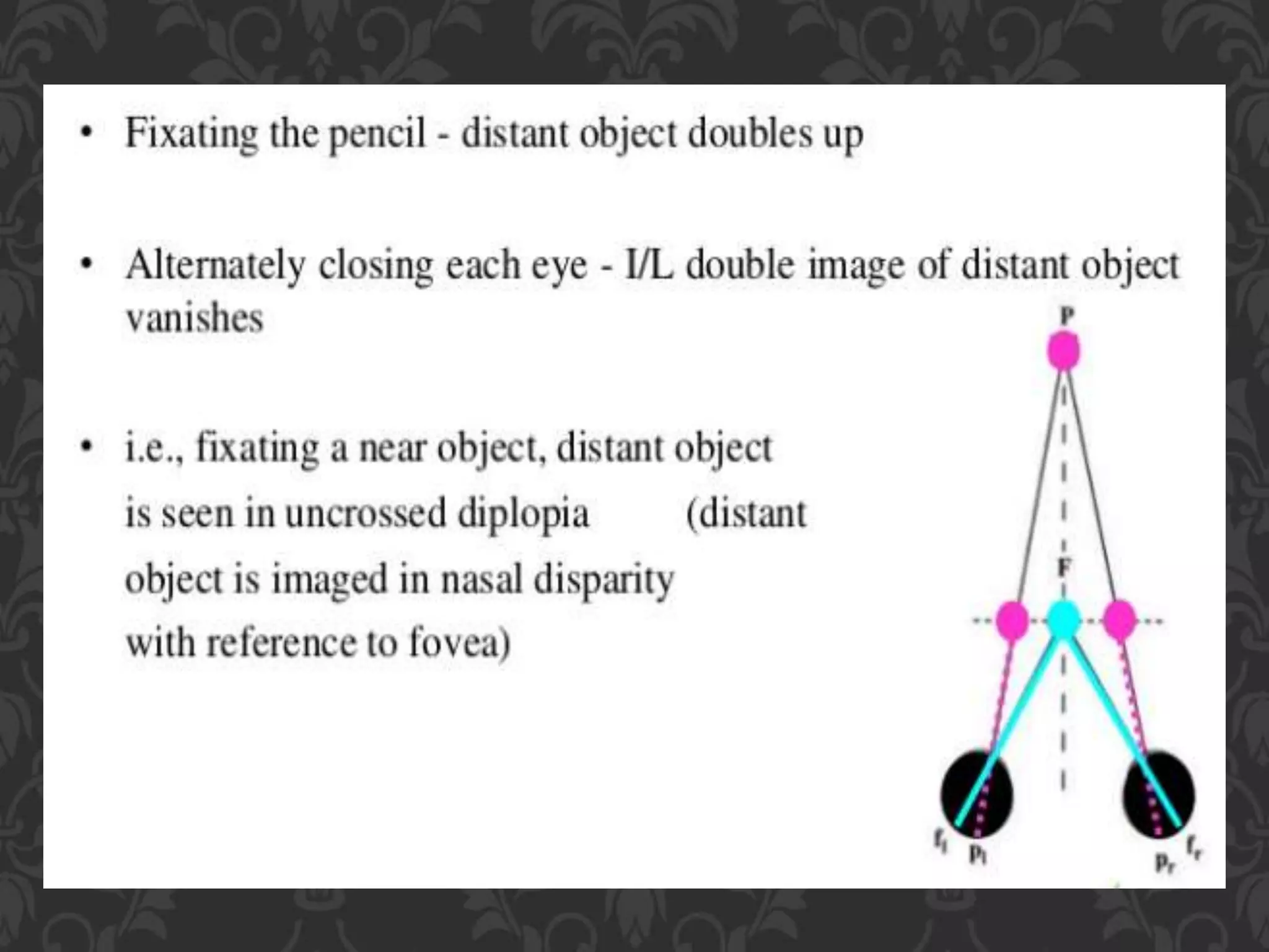 BASICS OF BINOCULAR VISION----1.pptx