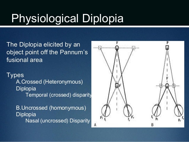 Basics of binocular vision