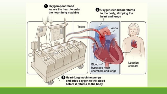 BASICS OF BIOMEDICAL INSTRUMENTATION | PPT