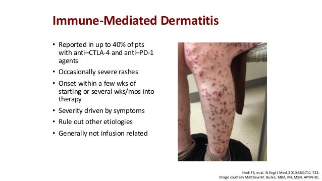 Basics of cancer immunotherapy 2017