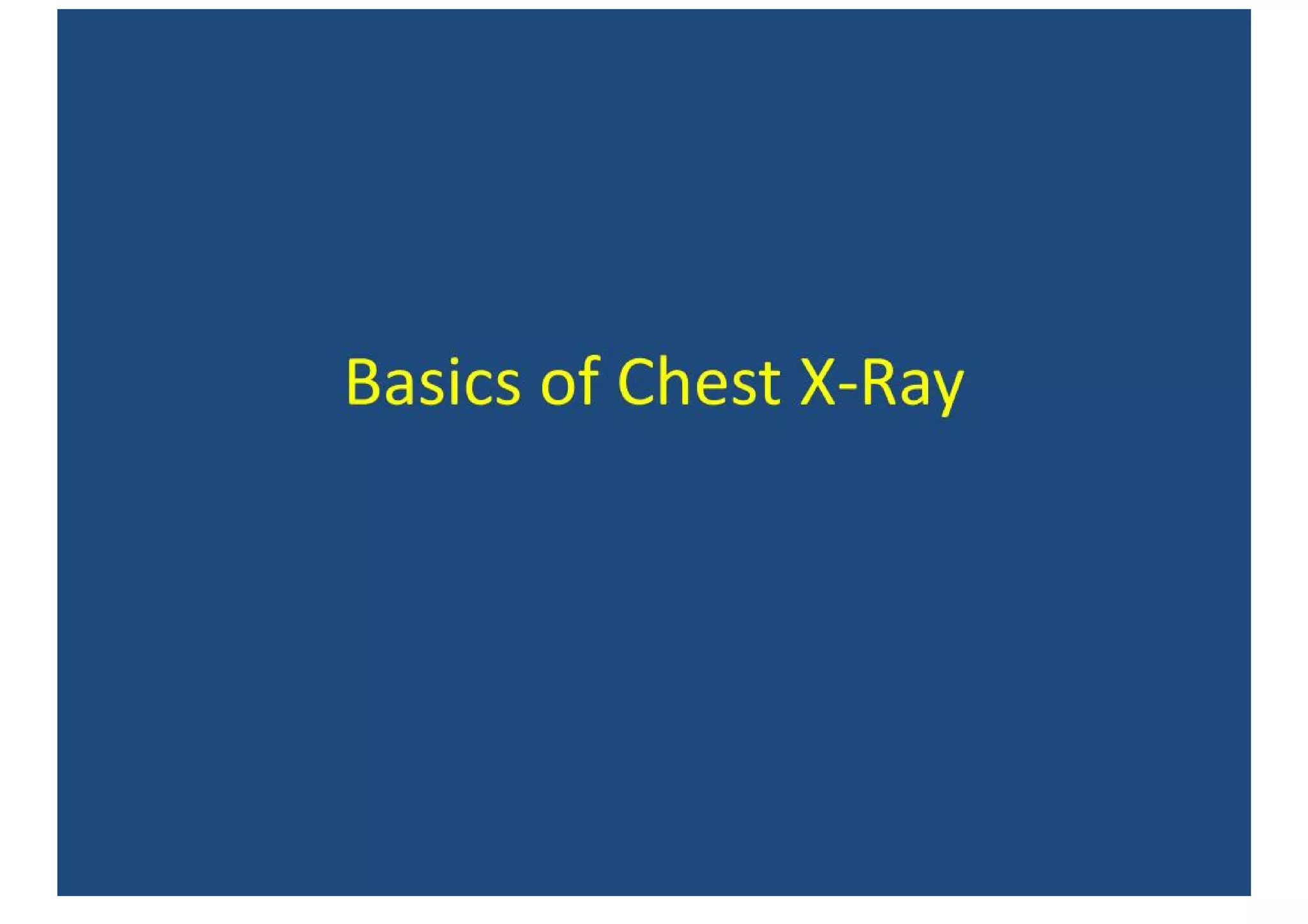 Basics Of Chest X-Ray | PDF