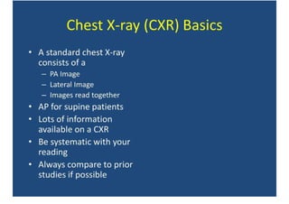 Basics Of Chest X-Ray | PDF