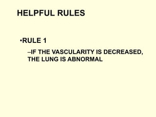 Basics of Chest X-ray Interpretation.pptx