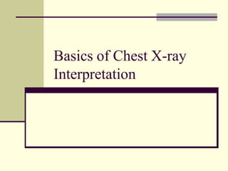 Basics of Chest X-ray Interpretation.pptx
