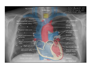 basics_of_chest_xray.pptx basic of chest x ray | PPTX