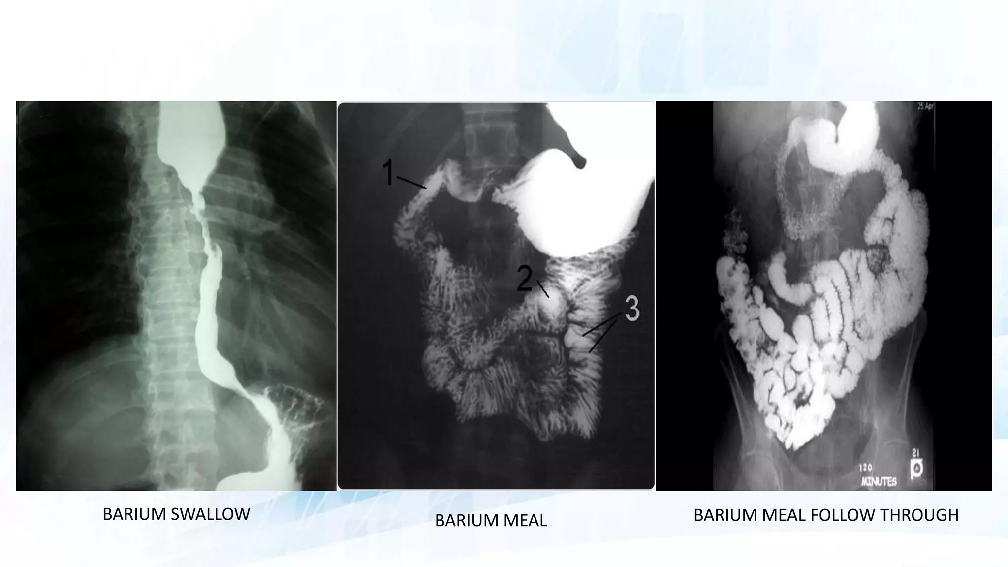 Basics of contrast media | PPTX