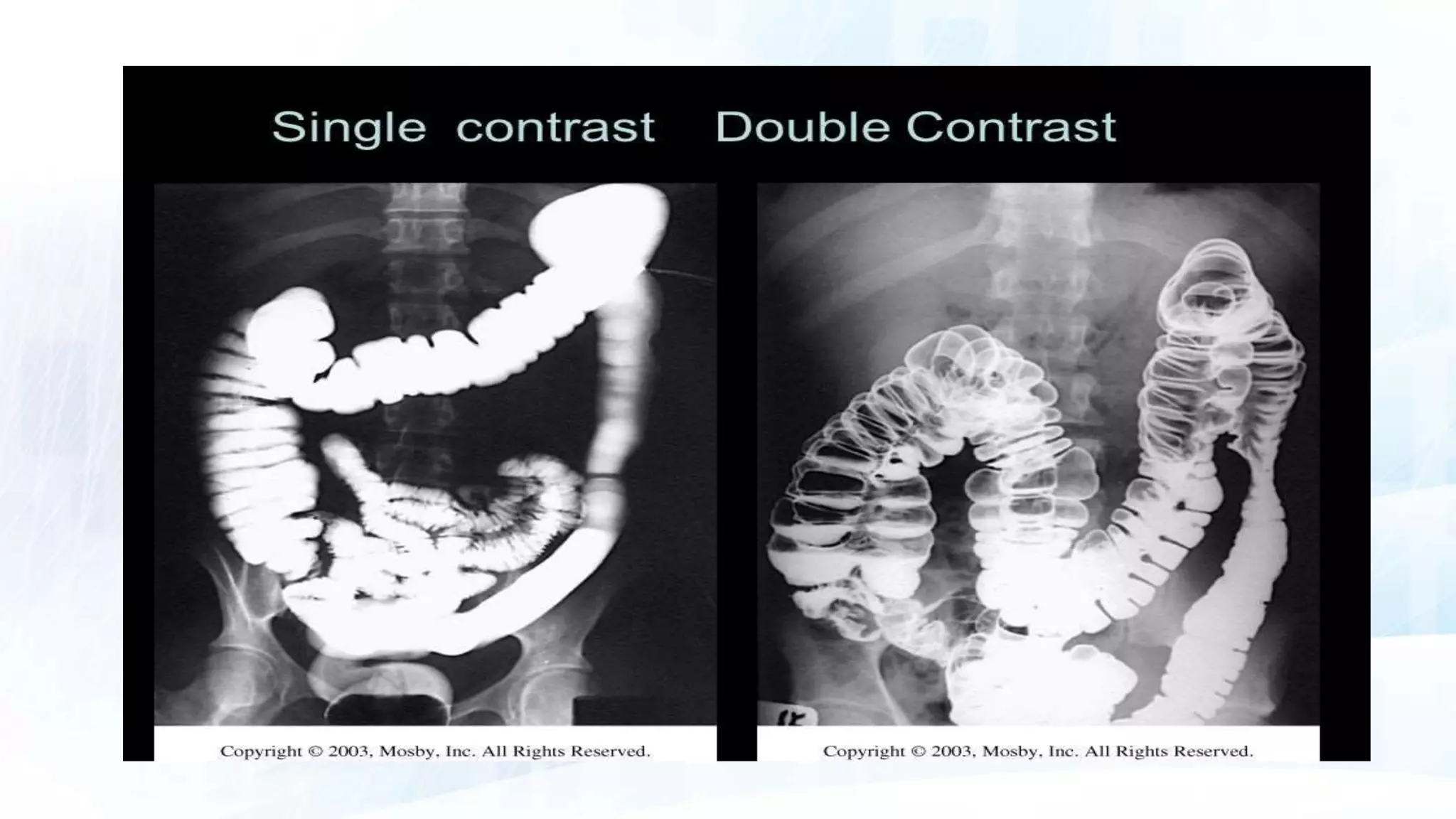 Basics of contrast media | PPTX