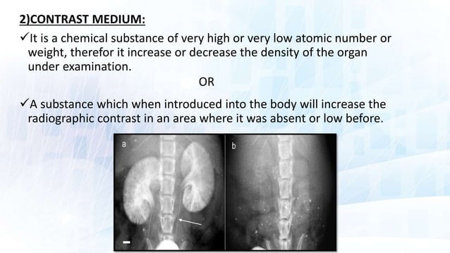 Basics of contrast media | PPTX | Digestive Disorders | Diseases and ...