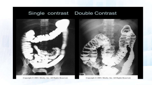 Basics of contrast media