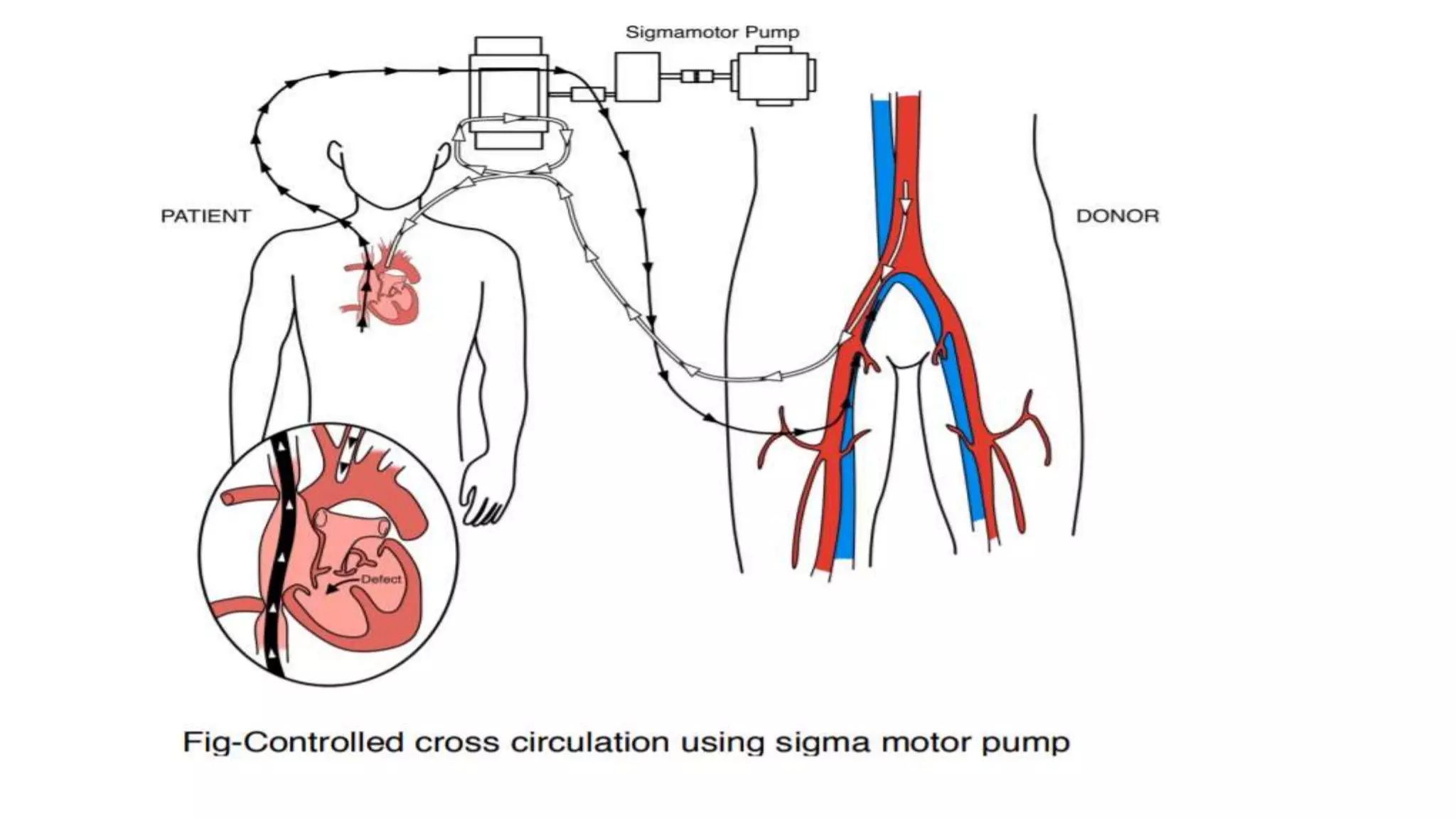 Basics of cpb | PPTX