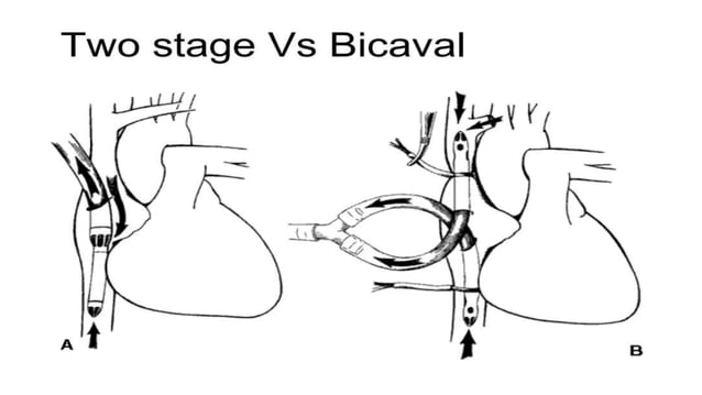 Basics of cpb | PPTX