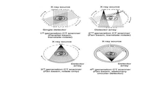 Basics of CT | PPTX