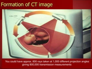 Basics of CT- Lecture 1.ppt