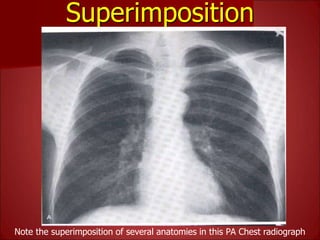 Basics of CT- Lecture 1.ppt