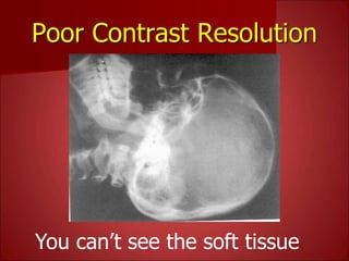 Basics of CT- Lecture 1.ppt