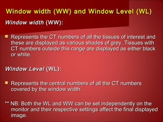 Basics of ct lecture 2 | PPT
