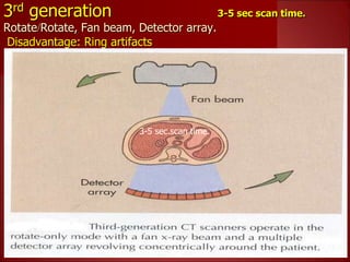 Basics of CT- Lecture 3.ppt