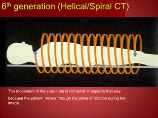 Basics of CT- Lecture 3.ppt