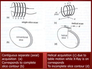 Basics of CT- Lecture 3.ppt
