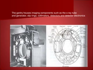 Basics of CT- Lecture 4.ppt
