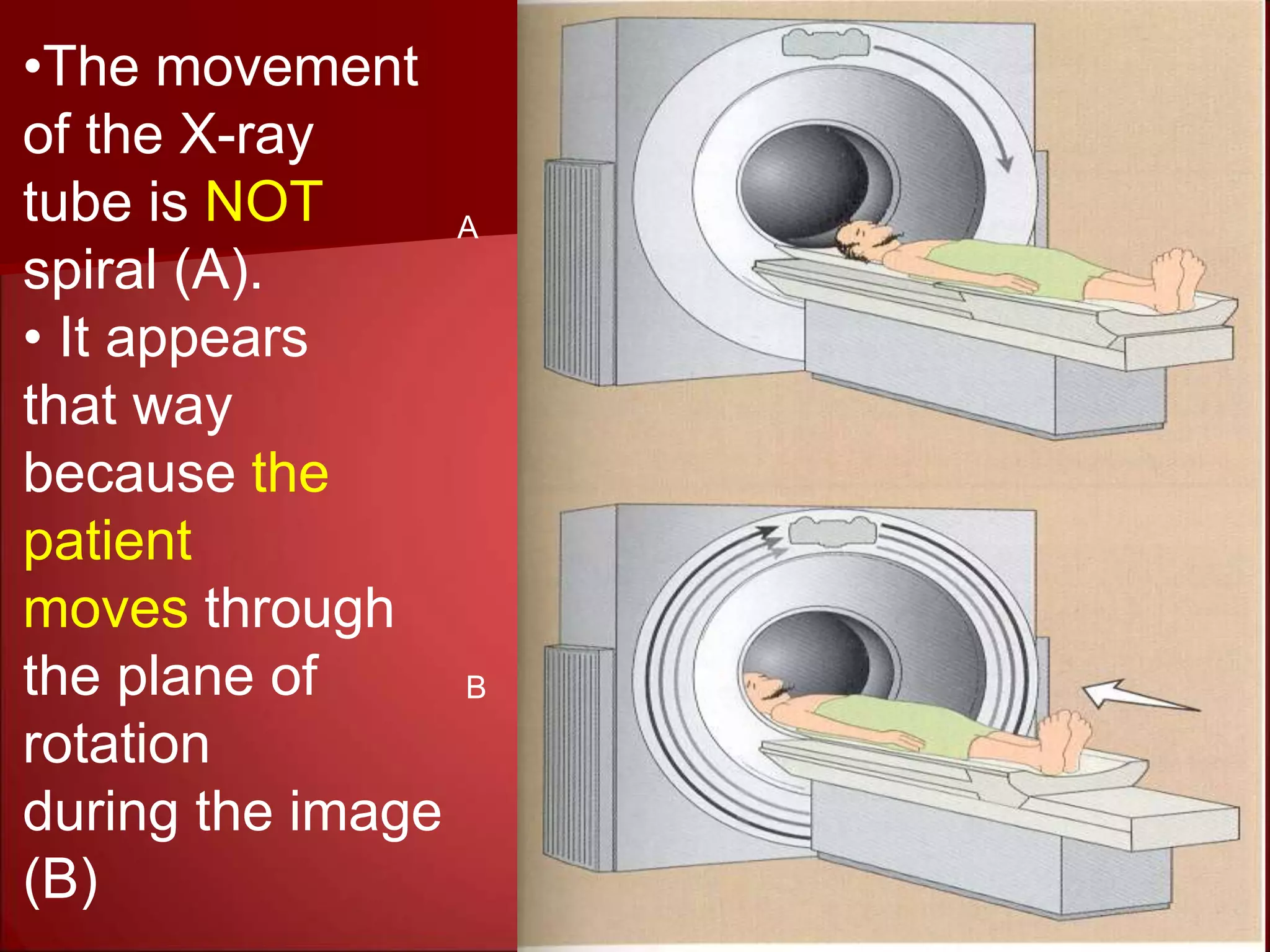 Basics of CT- Lecture 5.ppt