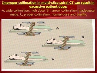 Basics of CT- Lecture 6.ppt