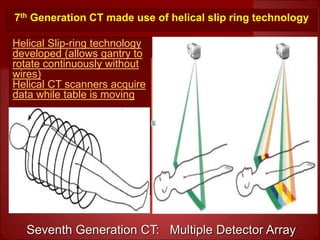 Basics of CT- Lecture 6.ppt